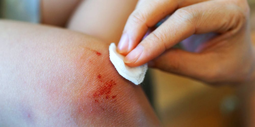 Cleaning Wounds: What is hydrogen peroxide used for? - The Ambulance ...